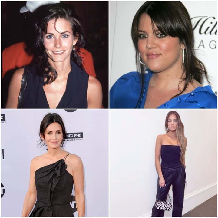 Famous Celebrities Who Admitted to Having Plastic Surgery